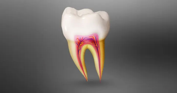 Root Canals Garland, TX | Root Canals Treatment Garland, TX